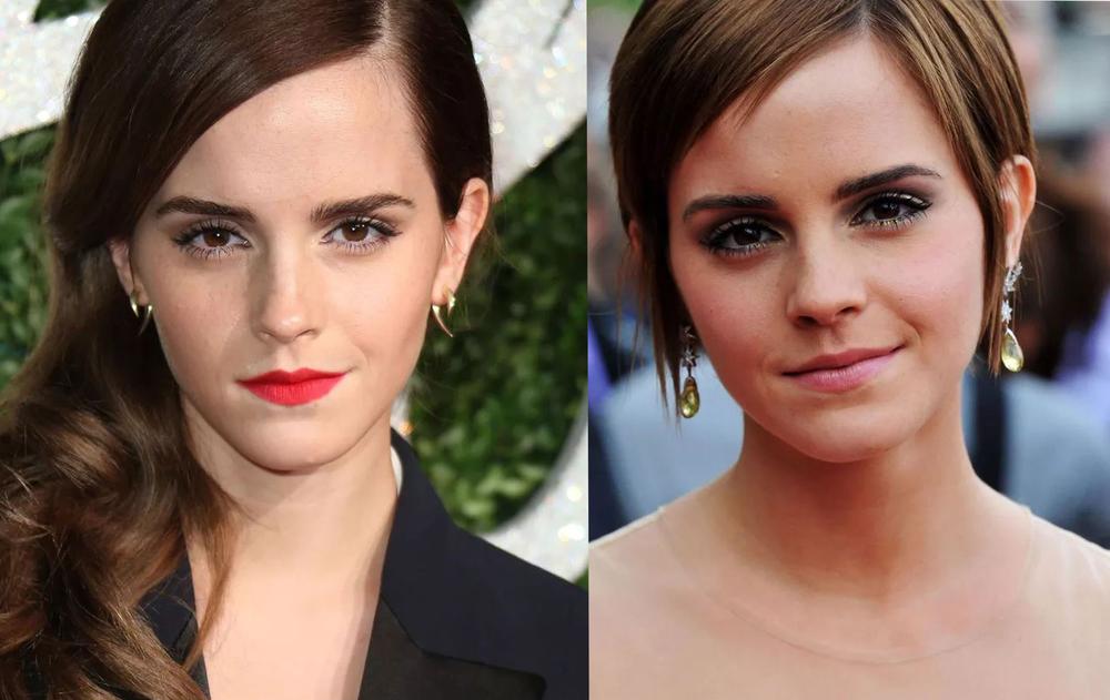 Crâne rasé, Emma Stone dévoile sa transformation la plus radicale