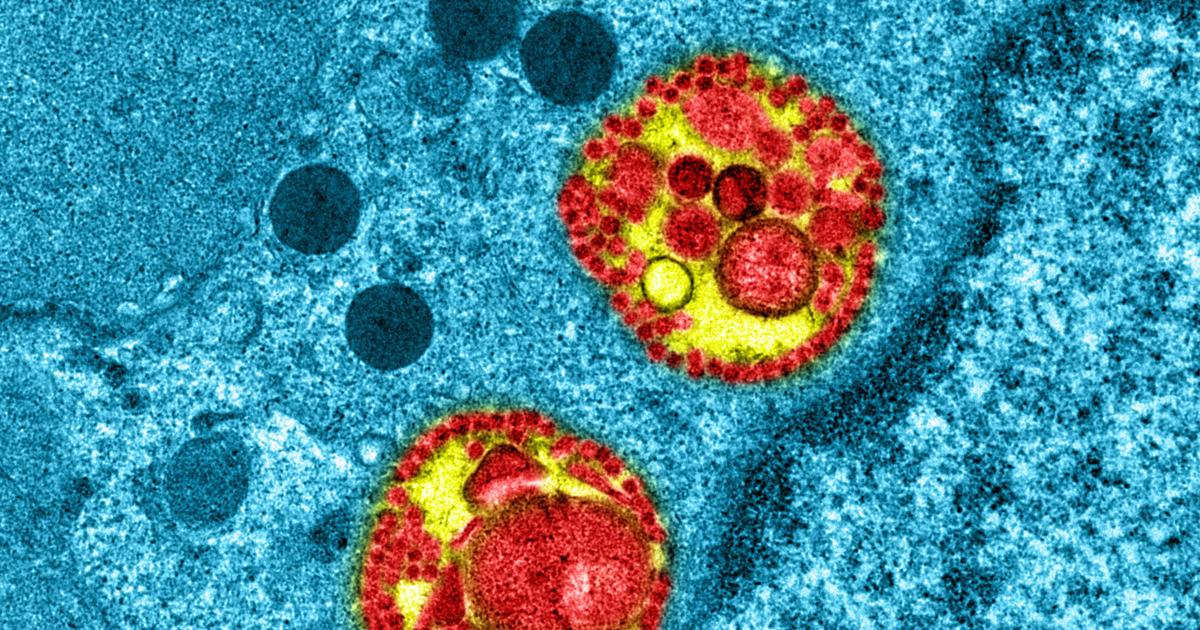 Qu'est-ce que le R0, le facteur de reproduction du virus
