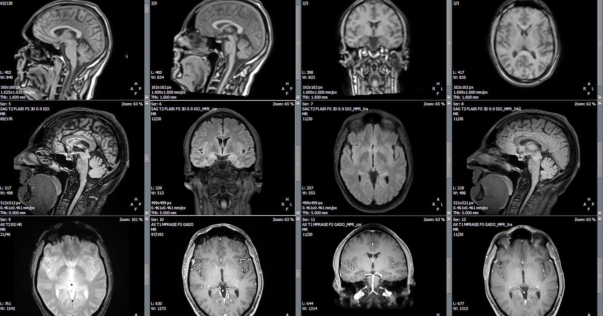 L'IRM le plus puissant pour observer le corps humain livre ses ...