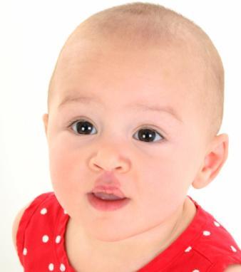 Angiome : tout savoir sur cette malformation vasculaire