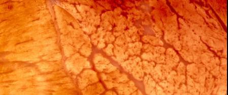 Biopsie musculaire : le déroulement et les indications