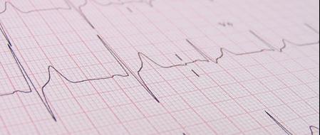 Insuffisance aortique : symptômes, traitement et évolution
