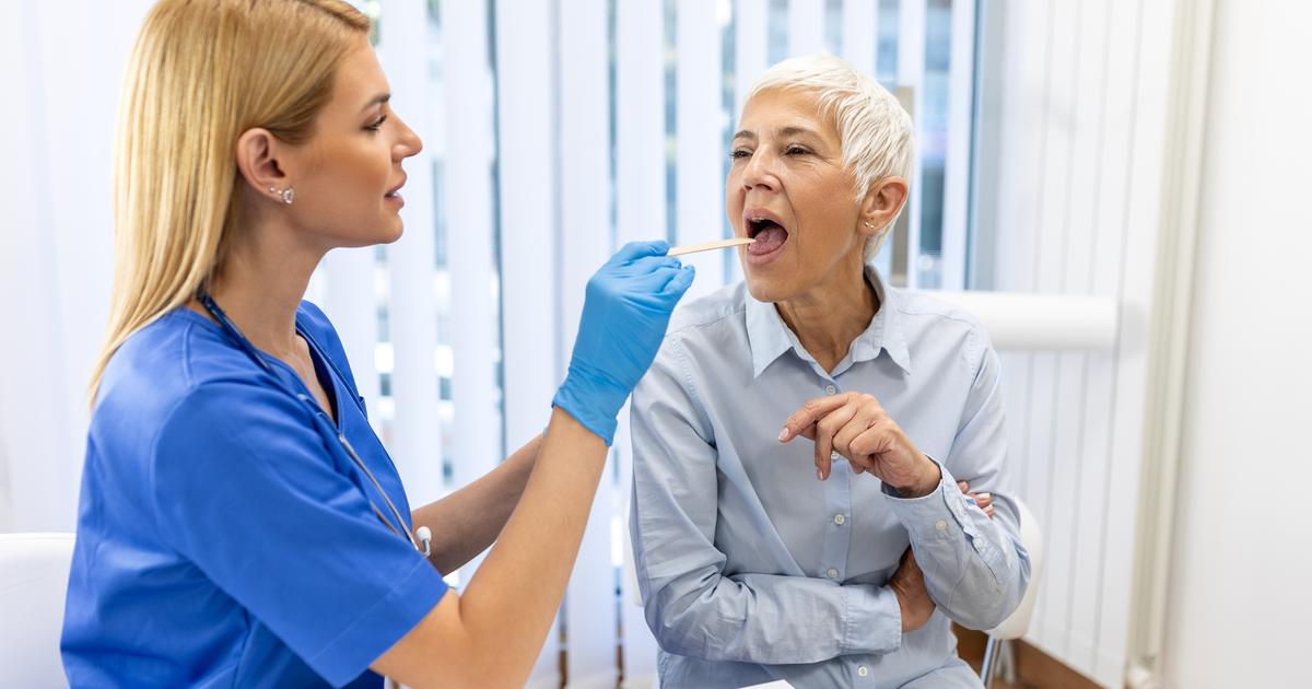 Cancer de la langue : symptôme, diagnostic et traitement