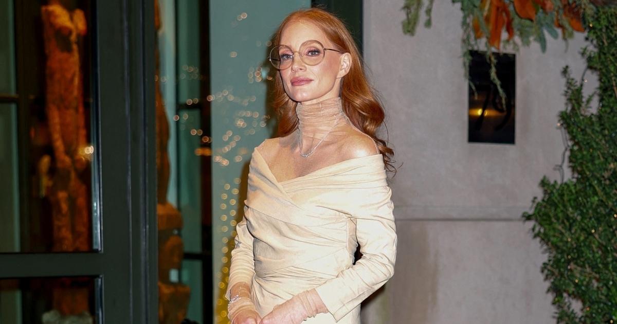 PHOTOS - De Leïla Bekhti à Lila Moss, les stars nous montrent comment porter le jaune beurre ...