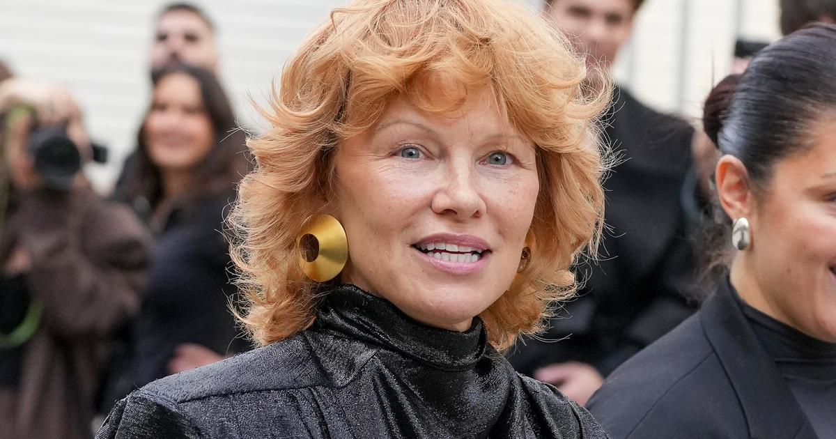 PHOTOS – Pamela Anderson, Kris Jenner... Ces transformations physiques ...