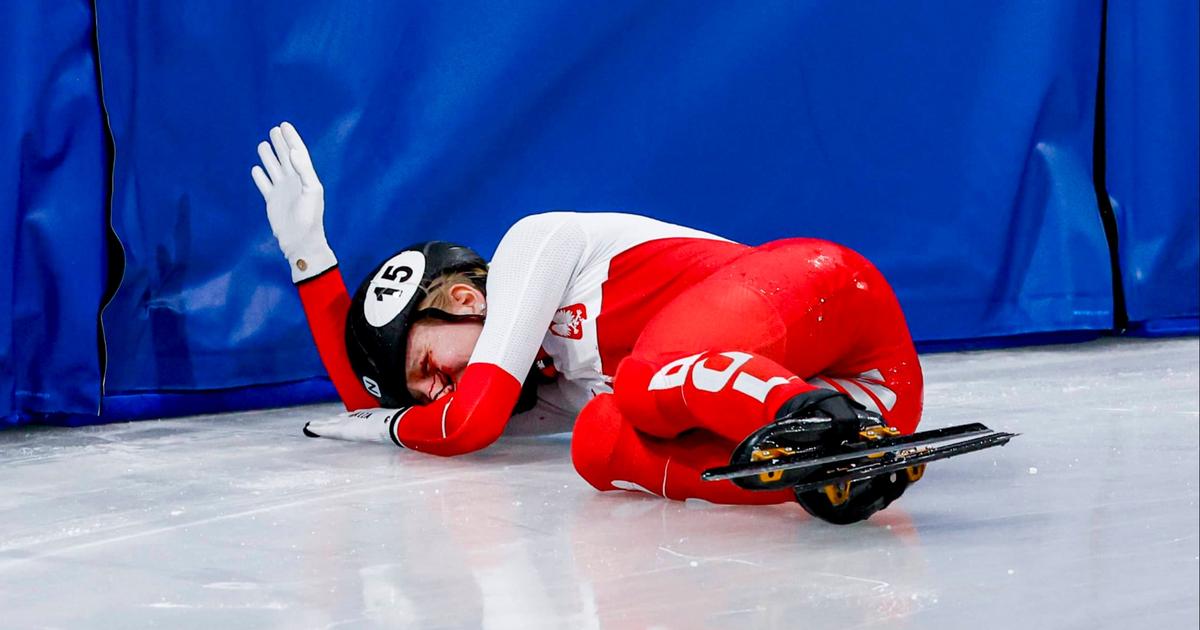 JO 2026 : après son effrayant accident au visage, la patineuse ...