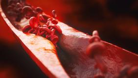 Diabète: quels sont les examens pour le diagnostiquer