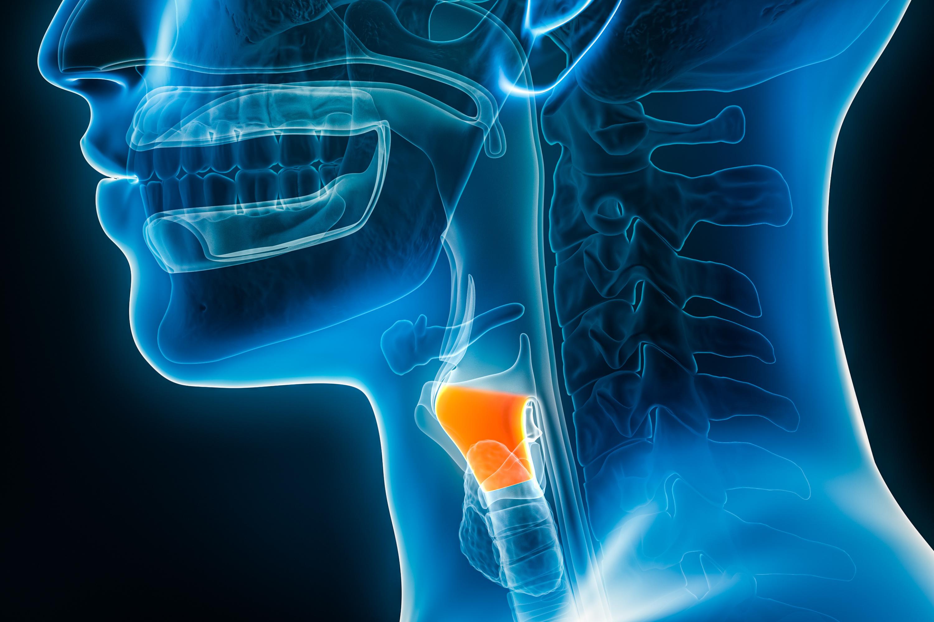 Die Behandlung Von Larynx- / Hypopharynxkarzinomen – IMWGHH