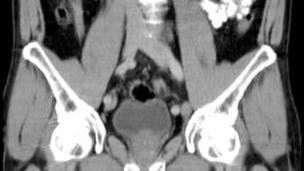 Uroscanner avec injection : préparation de l'examen