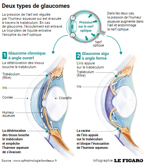 Douleur oculaire : informations et actualités