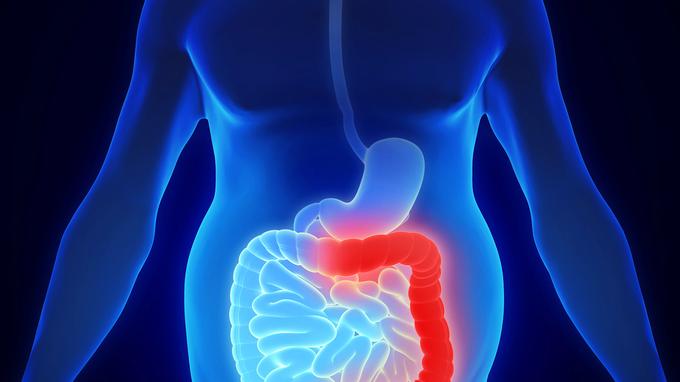 Occlusion intestinale: une urgence médicale