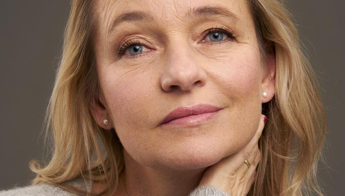Avant/après : Anne-Gaëlle, 54 ans, raconte ses injections dans les lèvres