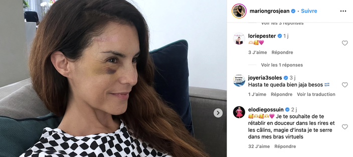 Élodie Gossuin n’oublie pas Marion Jollès-Grosjean, convalescente après son grave accident : “Je ...