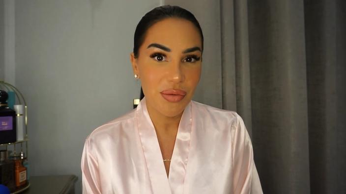 «J’ai mis de la graisse de mes genoux dans mon visage» : Milla Jasmine ...