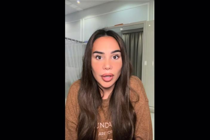 «J’ai mis de la graisse de mes genoux dans mon visage» : Milla Jasmine ...