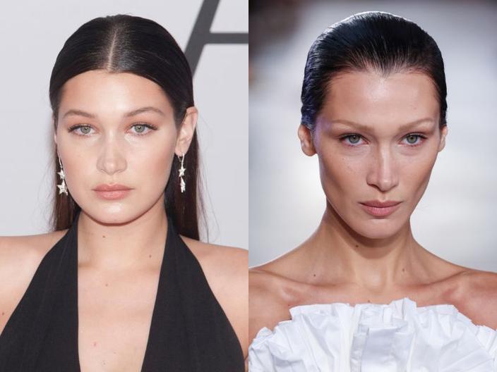 La bichectomie, cette chirurgie esthétique qui retire la graisse des joues