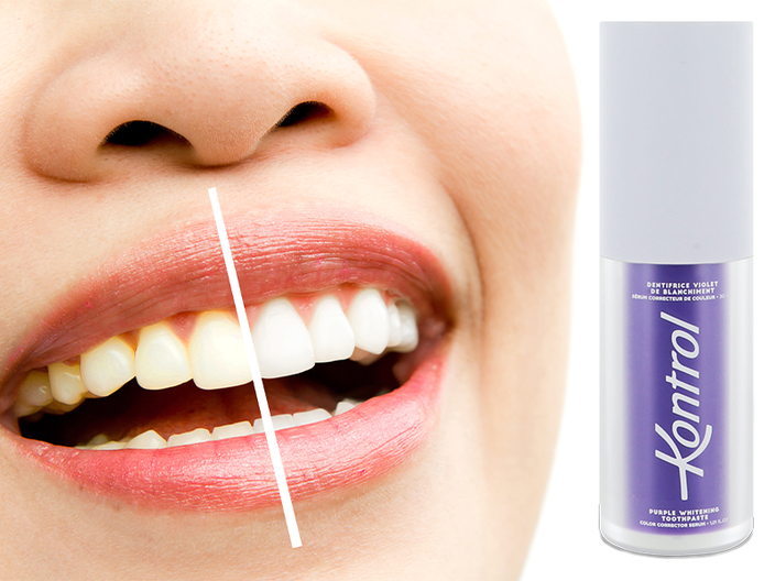 Dents blanches : on ne le soupçonnerait pas et pourtant ce dentifrice à ...