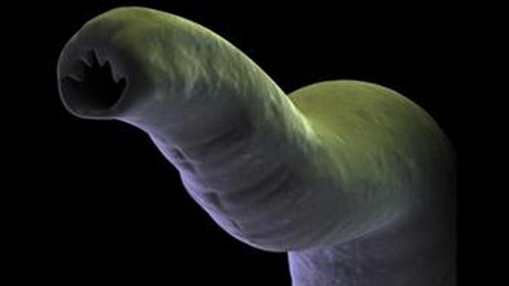 Cysticercose : Informations et actualités