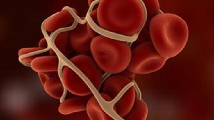Fibrinogène : analyse et interprétation des résultats
