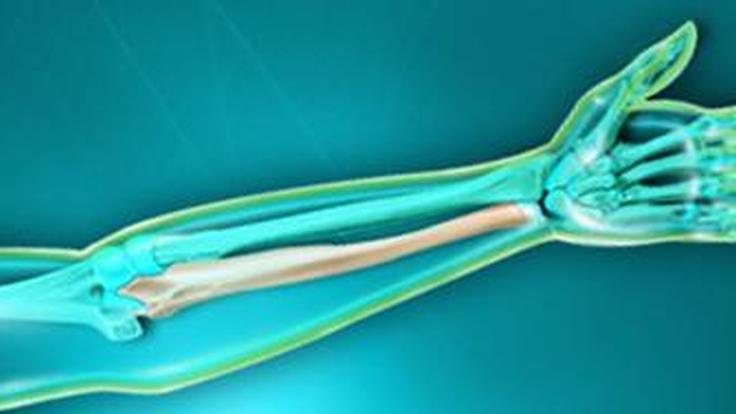 Cubitus ou ulna : son rôle essentiel dans l'organisme