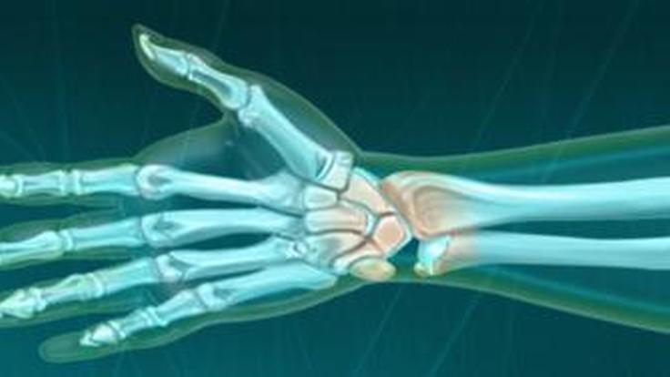 Mouvements du poignet : types, fonctions et exercices de santé