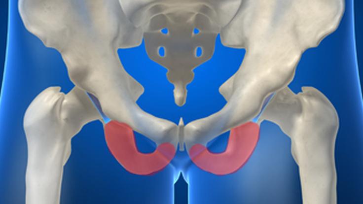 Ischion : anatomie, pathologies associées et traitements