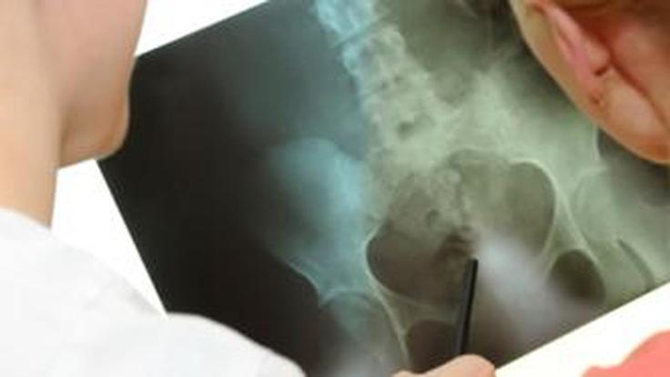 Urographie IV : indications et déroulement de l'examen