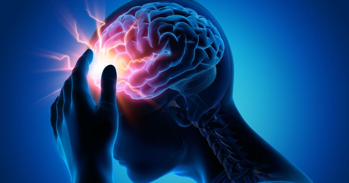 Qu’est-ce qu’un AVC?