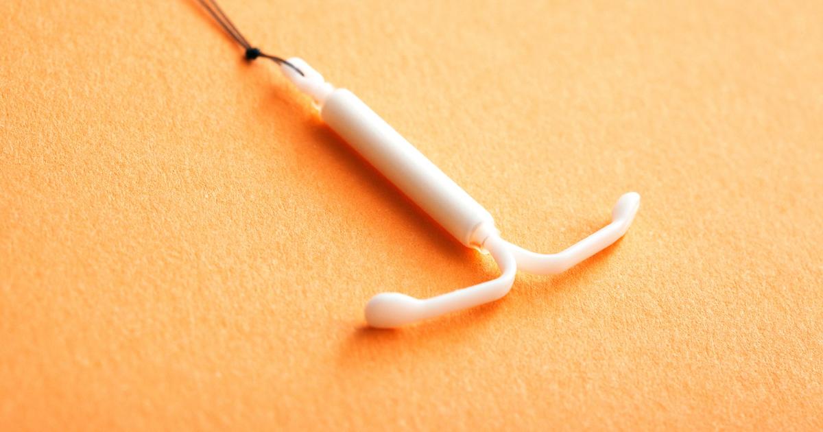 Le dosage du stérilet hormonal en question