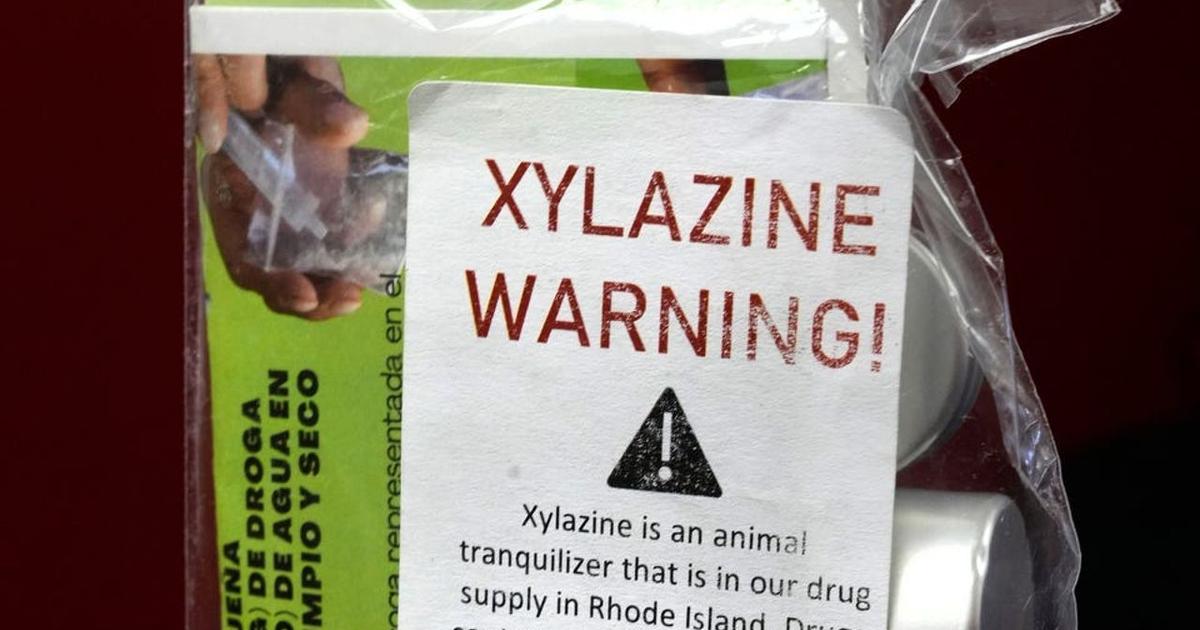 Après le fentanyl, la «drogue du zombie» fait des ravages aux États-Unis