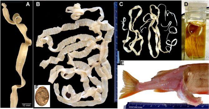 Sushis, poisson cru: quel est le risque d’attraper un ver parasite?