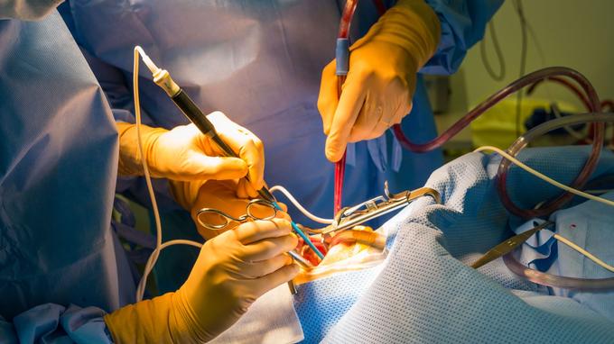 Amygdales : des interventions moins fréquentes et moins traumatiques