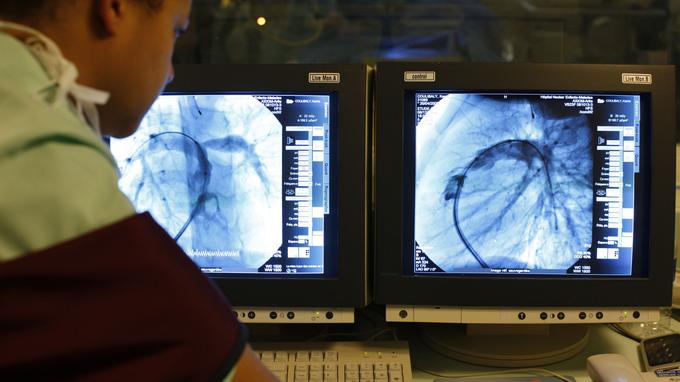 Malformation cardiaque à la naissance: 9 enfants sur 10 atteignent l ...