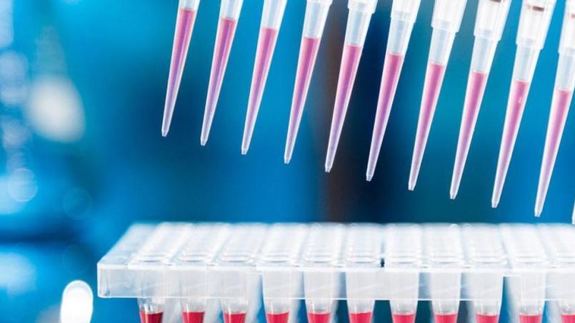Innovation Around Non Invasive Tests For The Early Diagnosis Of Cancers Archyde