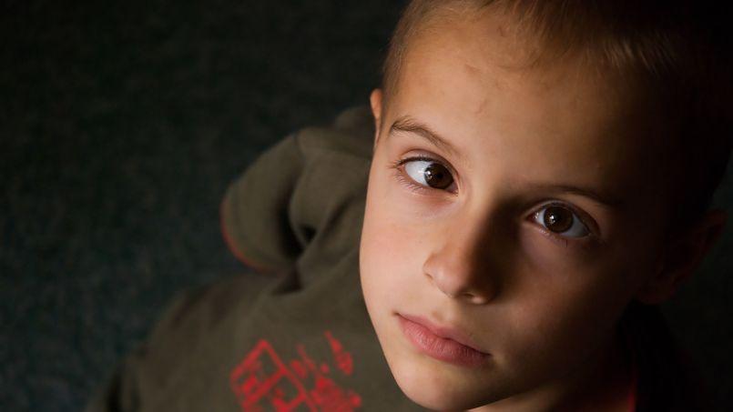Strabisme de l'enfant : consulter sans tarder