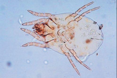 Des acariens découverts dans l'oreille d'un Taïwanais