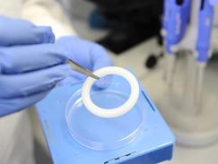 Un anneau contraceptif qui protège aussi contre le VIH