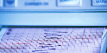 Electrocardiogramme - Qu’est-ce que c’est ? - Fiches santé et conseils ...