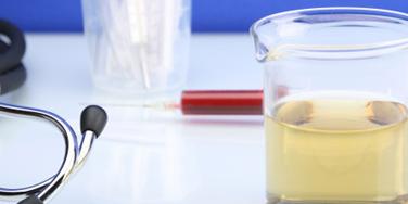 Hématurie (Sang dans les urines) - Quelles causes ? - Fiches santé et ...