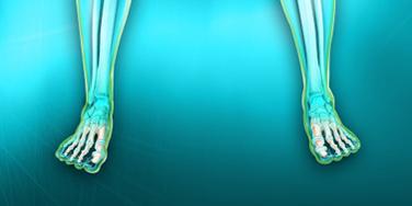 Métatarse - Qu’est-ce que c’est ? - Fiches santé et conseils médicaux