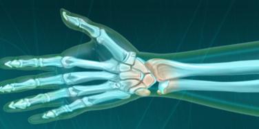 Poignet - Qu’est-ce que l’articulation radio-carpienne ? - Fiches santé ...