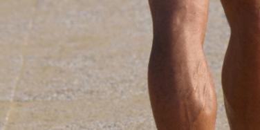 Remplissage des mollets - Qu'est ce que c'est ? - Fiches santé et ...