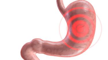 Ulcère gastroduodénal - Qu'est-ce que je ressens ? - Fiches santé et ...