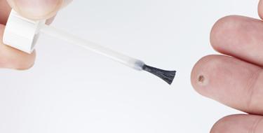 Verrues - Qu’est ce que c’est ? - Fiches santé et conseils médicaux