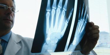 Ostéopénie - Qu'est ce que c'est ? - Fiches santé et conseils médicaux