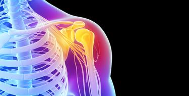Périarthrite scapulohumérale - Tendinite calcifiante - Fiches santé et ...