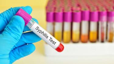 Syphilis - Quel traitement ? - Fiches santé et conseils médicaux