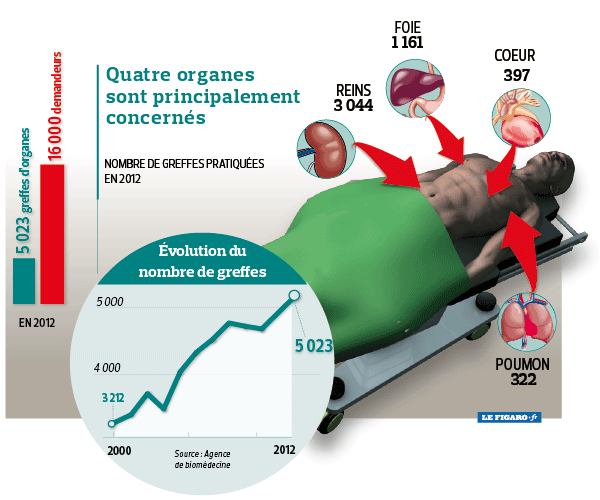 Plus de 5000 greffes réalisées en France l'an dernier