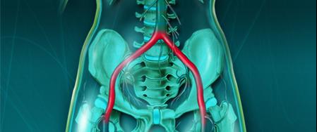 Artère iliaque - Qu’est-ce que c’est ? - Fiches santé et conseils médicaux