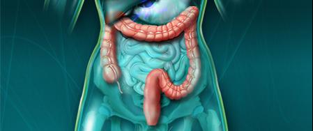 Côlon - Quelles sont les principales maladies du côlon ? - Fiches santé ...
